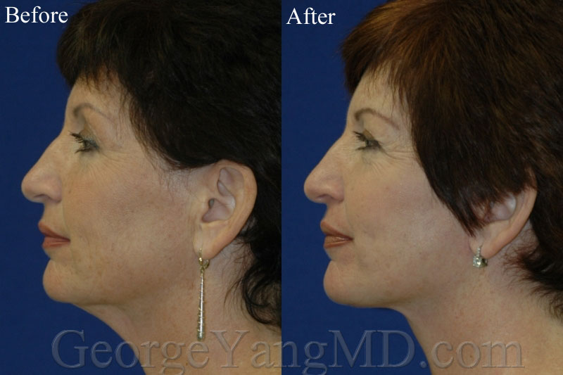 Home | George Yang MD Facial Plastic Surgery New York